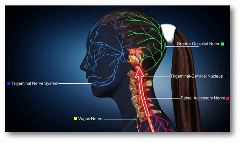 Frequently Asked Questions | Texas Migraine Clinic